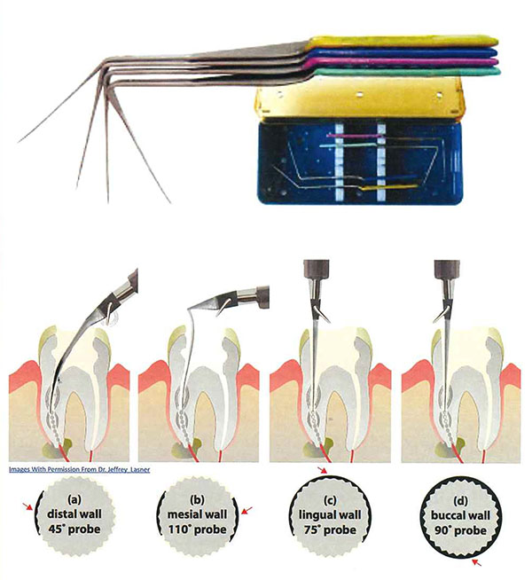 LASCHAL FXP Endo Probe Set- ritterimplants