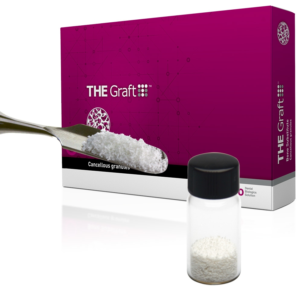 MatrixCellect® 100 DBM Putty, 0.5cc Syringe - copy- ritterimplants